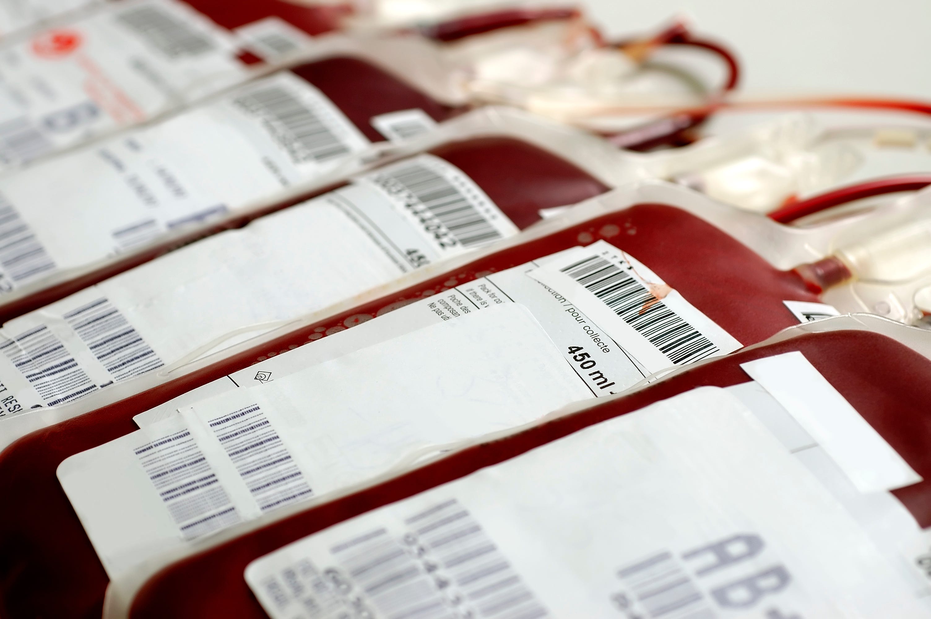 Transfusion-associated lung injury (TRALI): Review