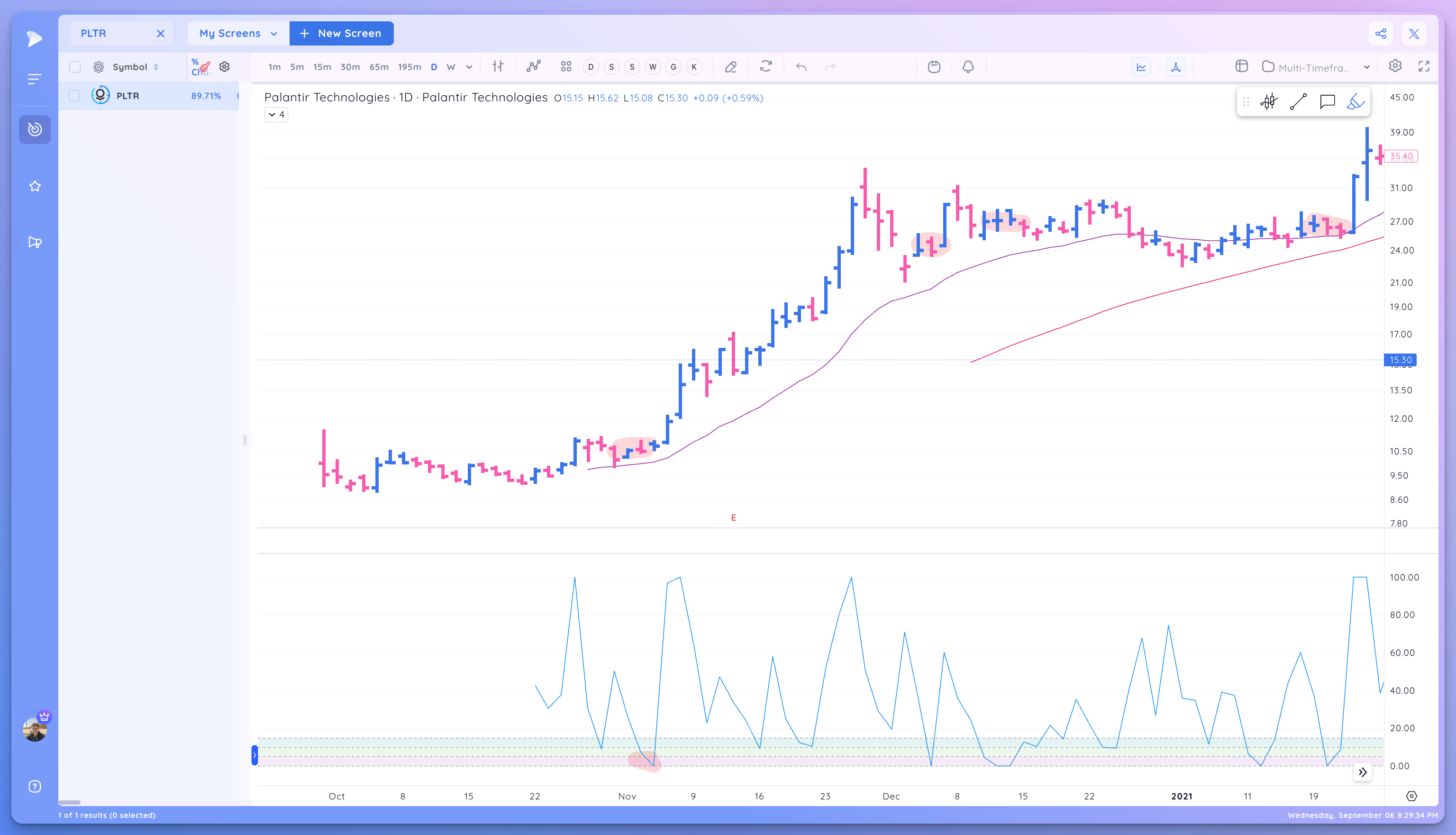 How to Find and Trade VCPs / Tight Areas using Deepvue