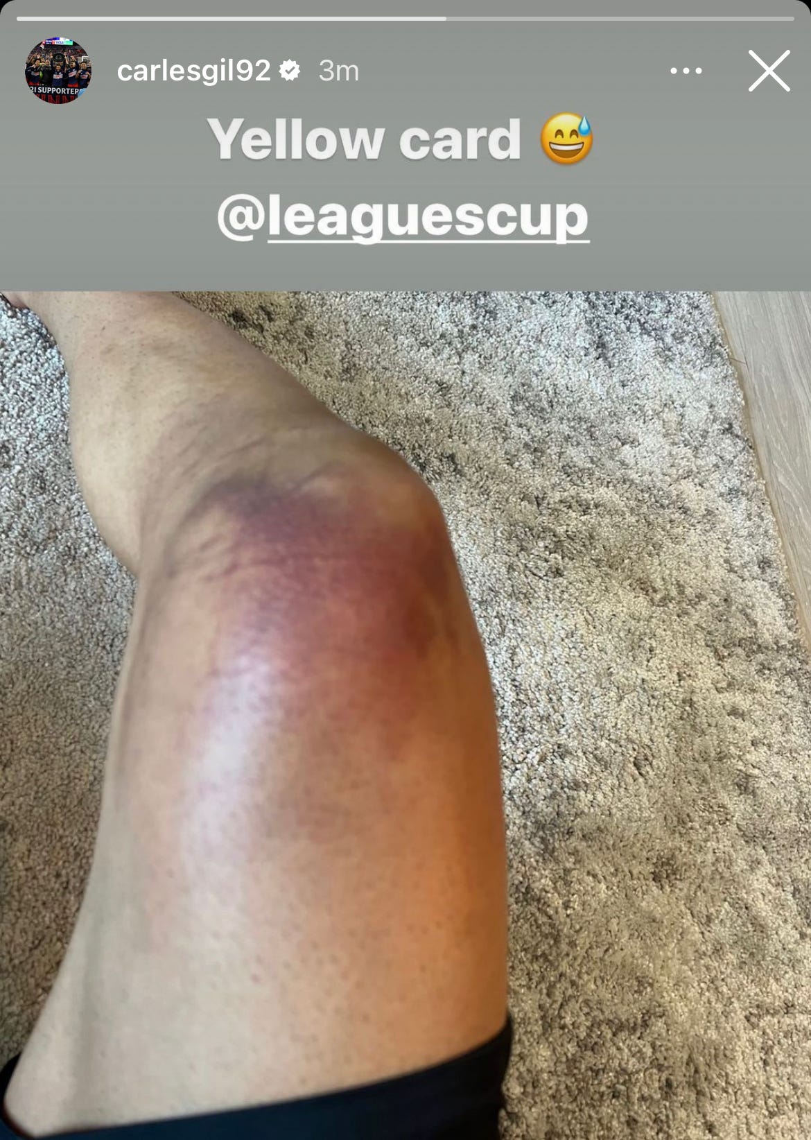 Carles Gil Injury Update - by Josh Nye - The Blazing Musket