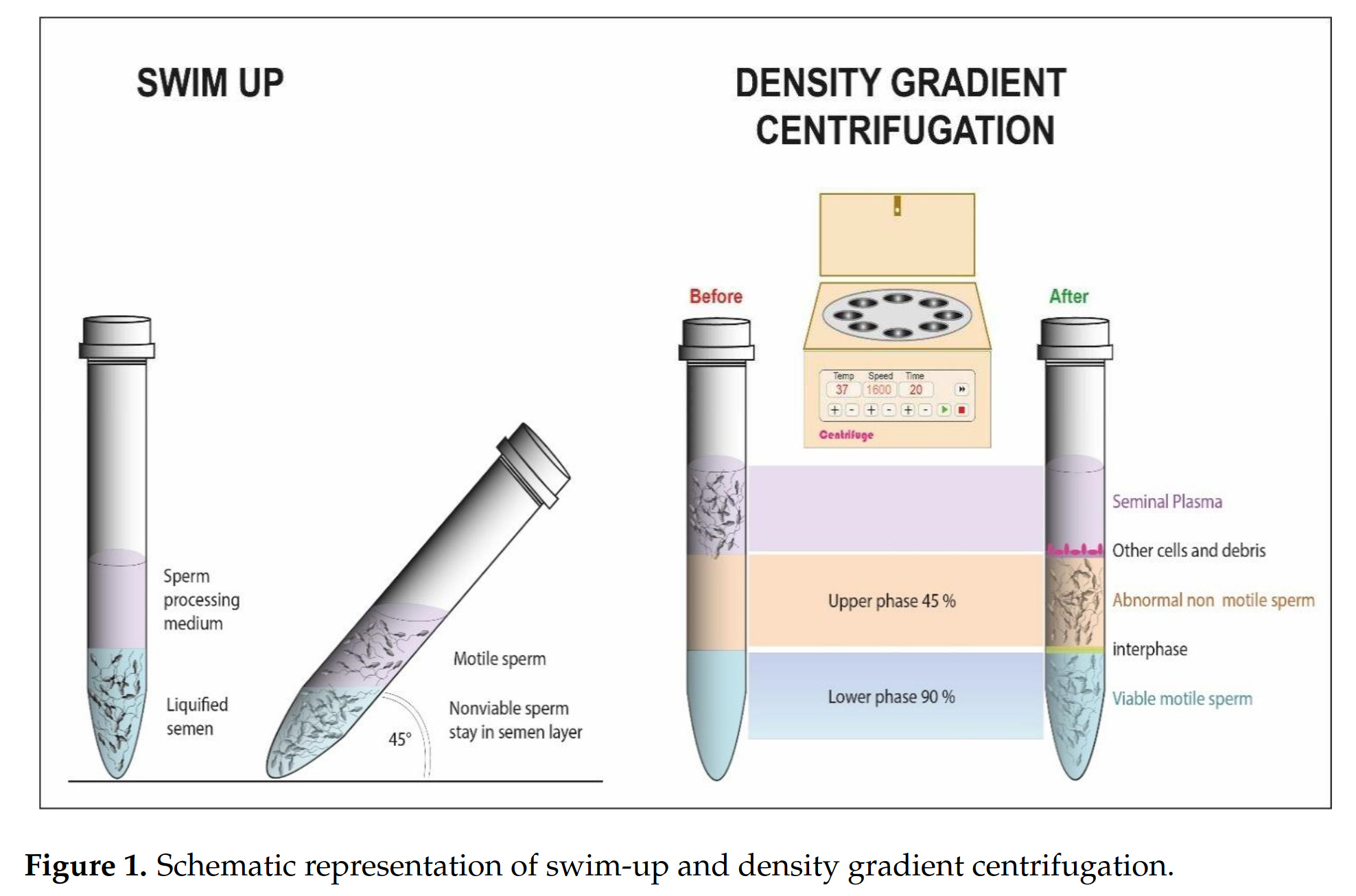 Can we pick the best sperm? - by Emil O. W. Kirkegaard