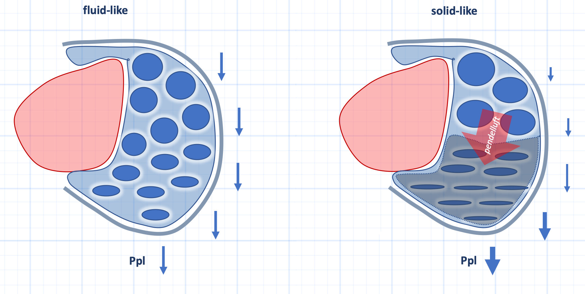 ICU Physiology in 1000 Words: Patient Self-Inflicted Lung Injury – Part 2