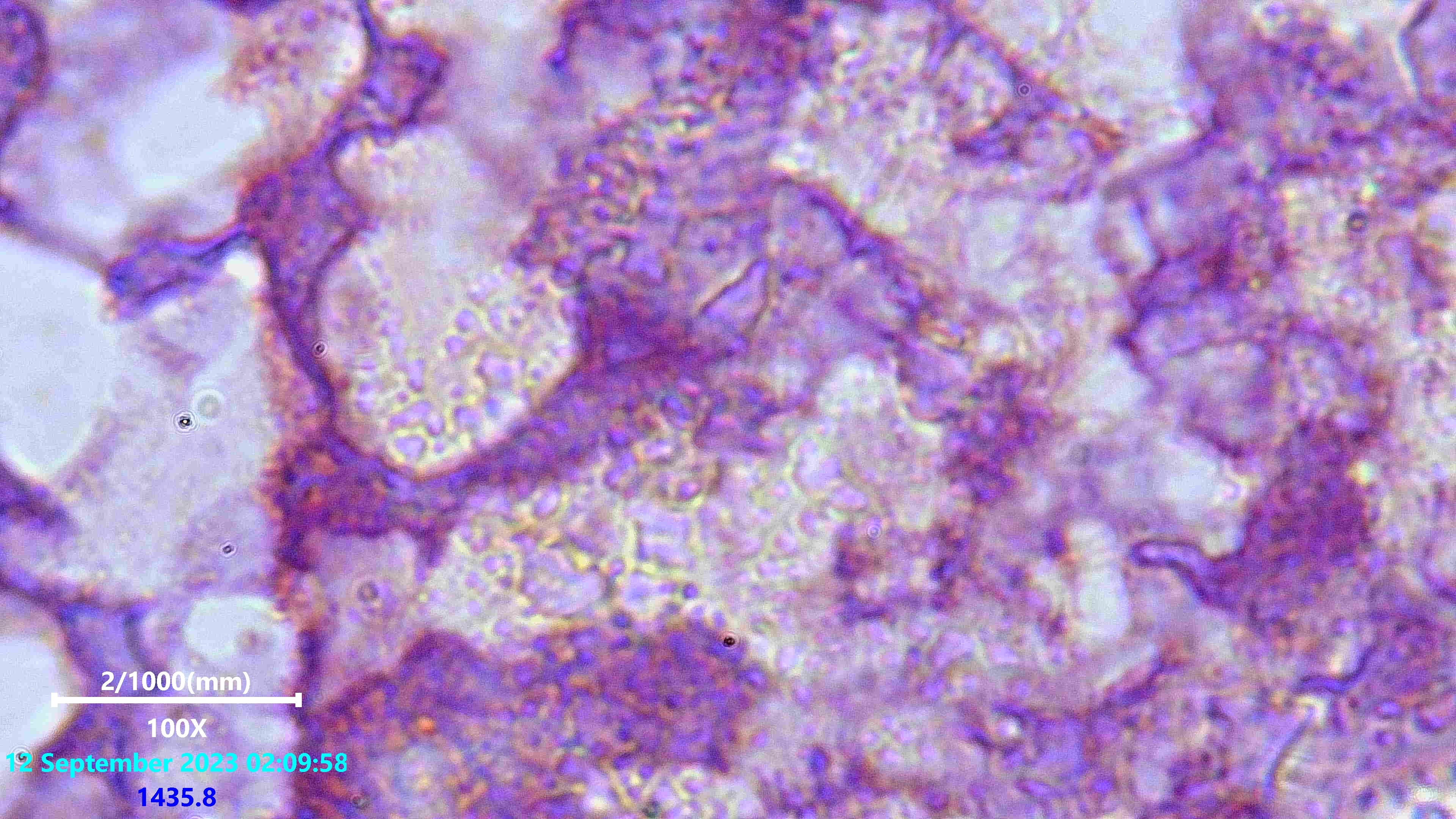 Gram staining of my blood reveals same abnormalities shown by ...