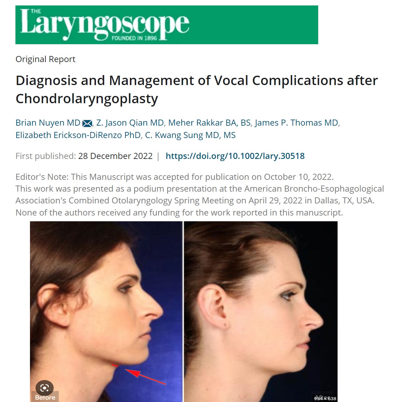Diagnosis and Management of Vocal Complications after Transgender ...