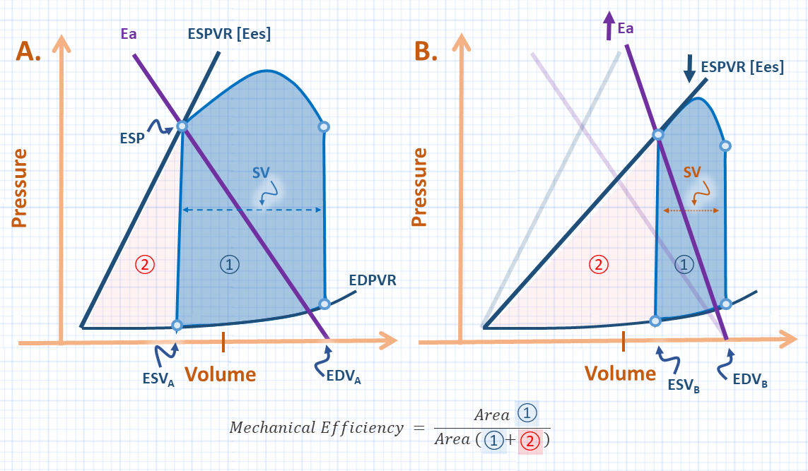 ICU Physiology in 1000 Words: Venous Doppler & Veno-Cardiac Coupling – Part 1