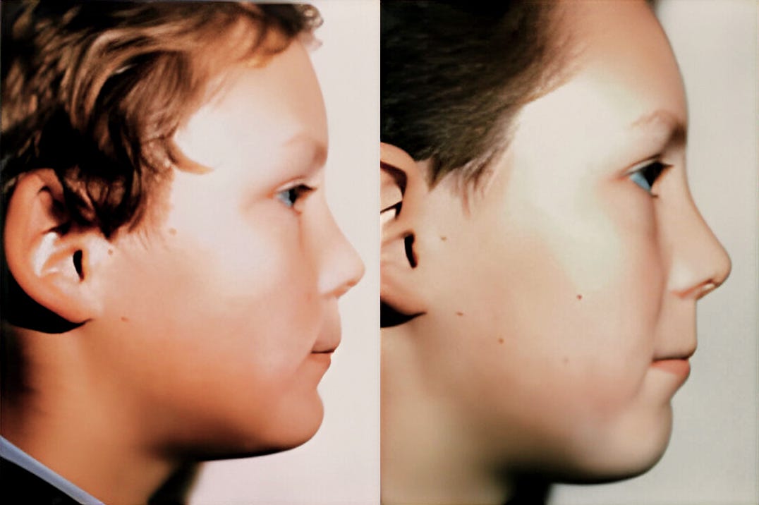 1.2 What Makes a Face Attractive? - by Ronald Ead