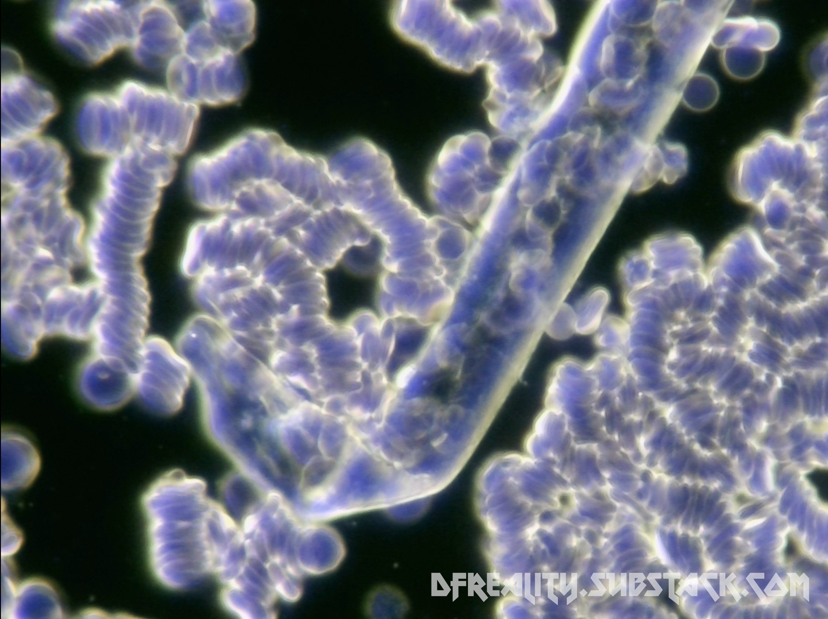 The Mass Poisoning of America: A Case Study