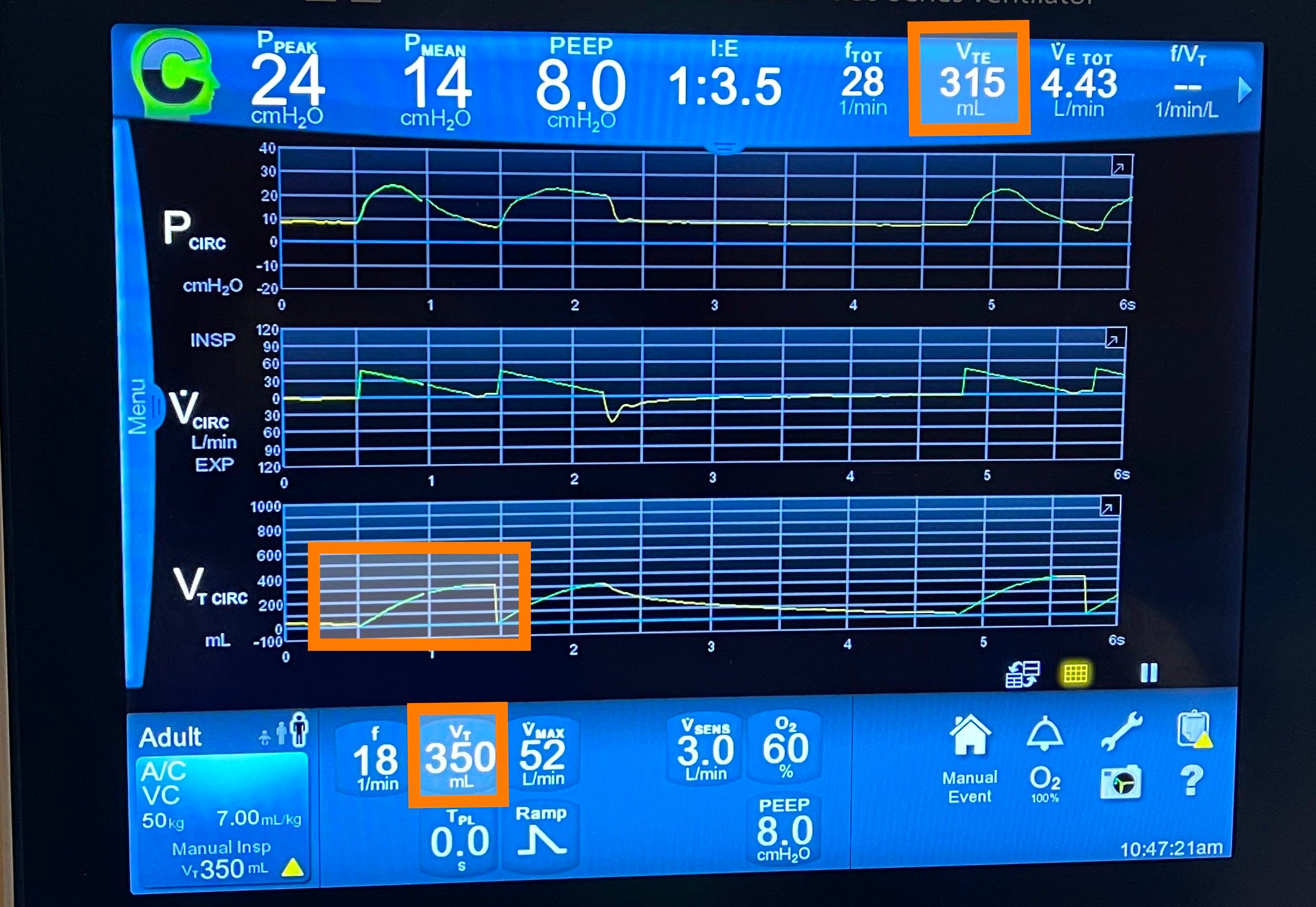 Mechanical Ventilation Made Simple: 9 Concepts Every Non-ICU Doc Should ...