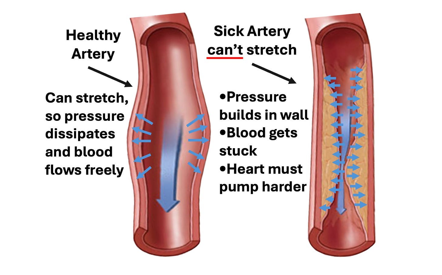 The Great Dangers of Blood Pressure Medications