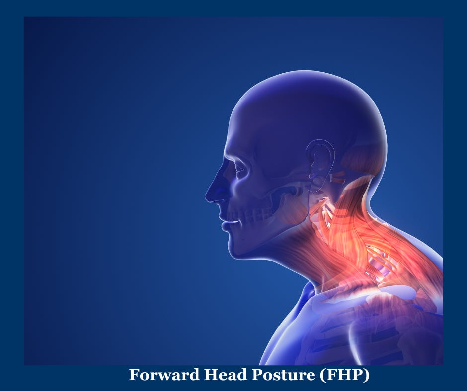 Do You Look Like a Human Turtle? How to Tackle Forward Head Posture