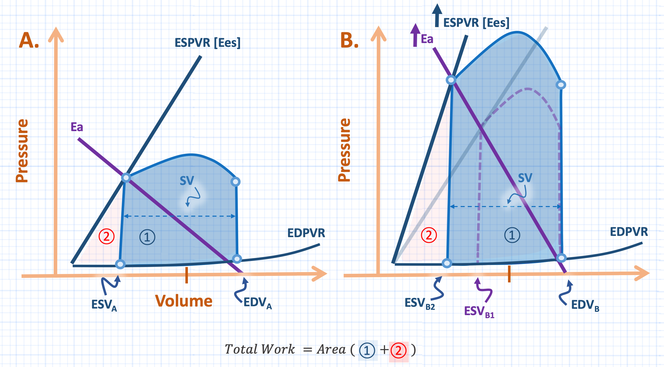 ICU Physiology in 1000 Words: Pulmonary Embolism & Right Ventricular ...