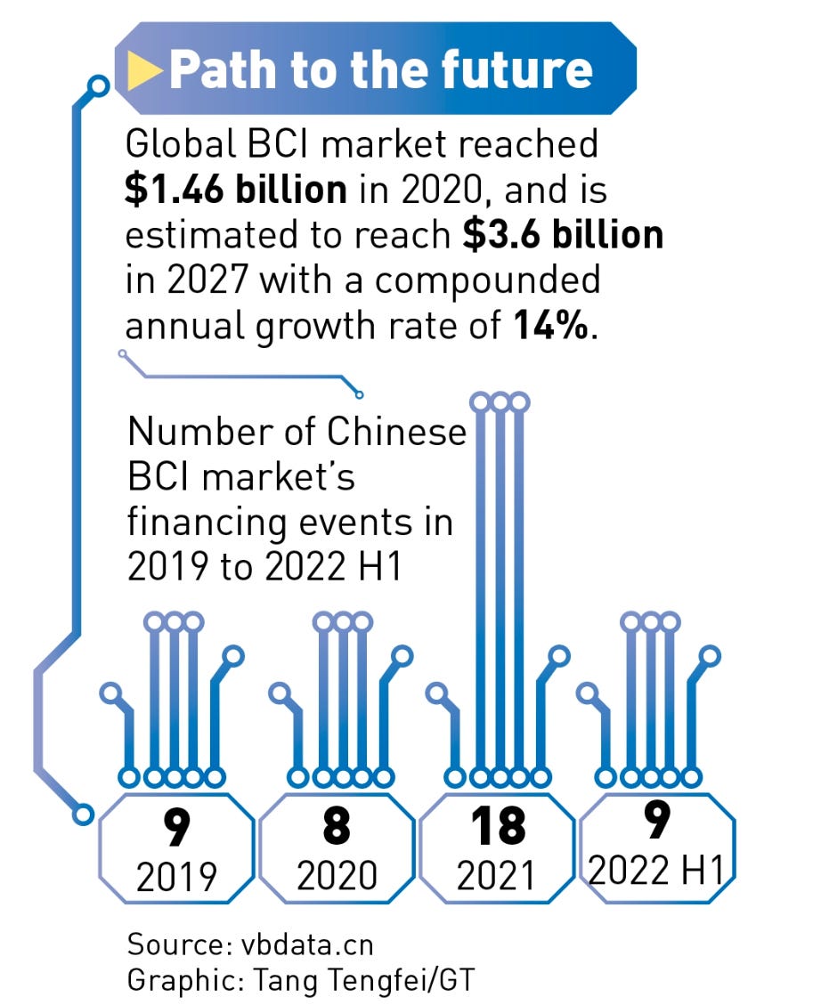 Is the Next Device & Interface an A.I. Personal Assistant in a Brain ...