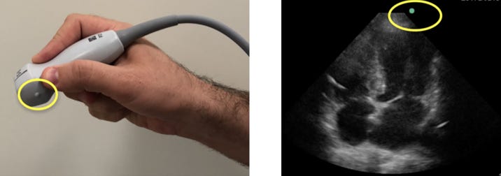 Ultrassom Focado do Coração (FOCUS)