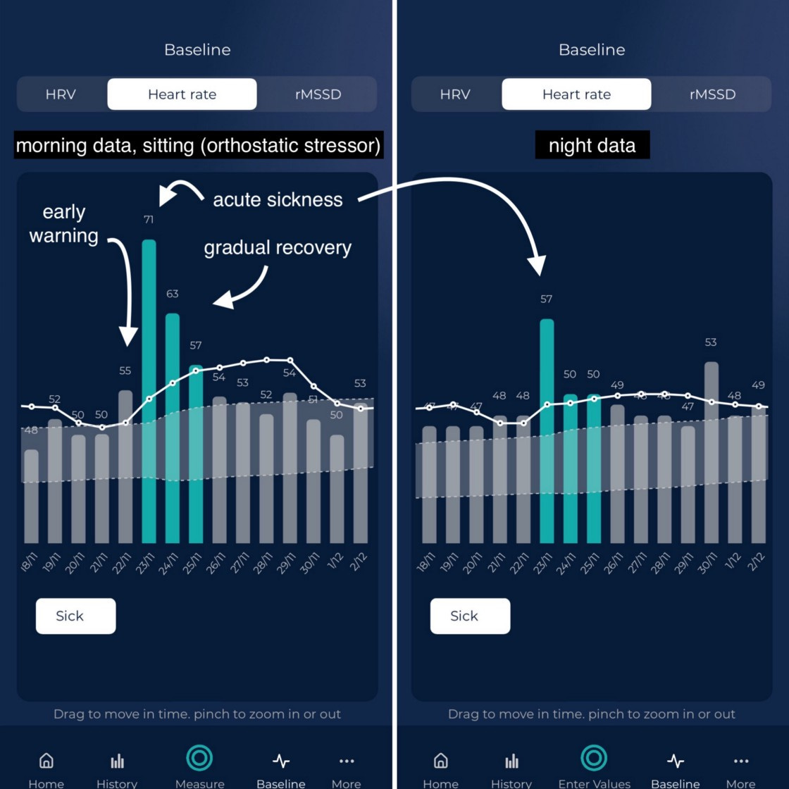 Heart rate variability (HRV) measurement position: lying down, sitting ...