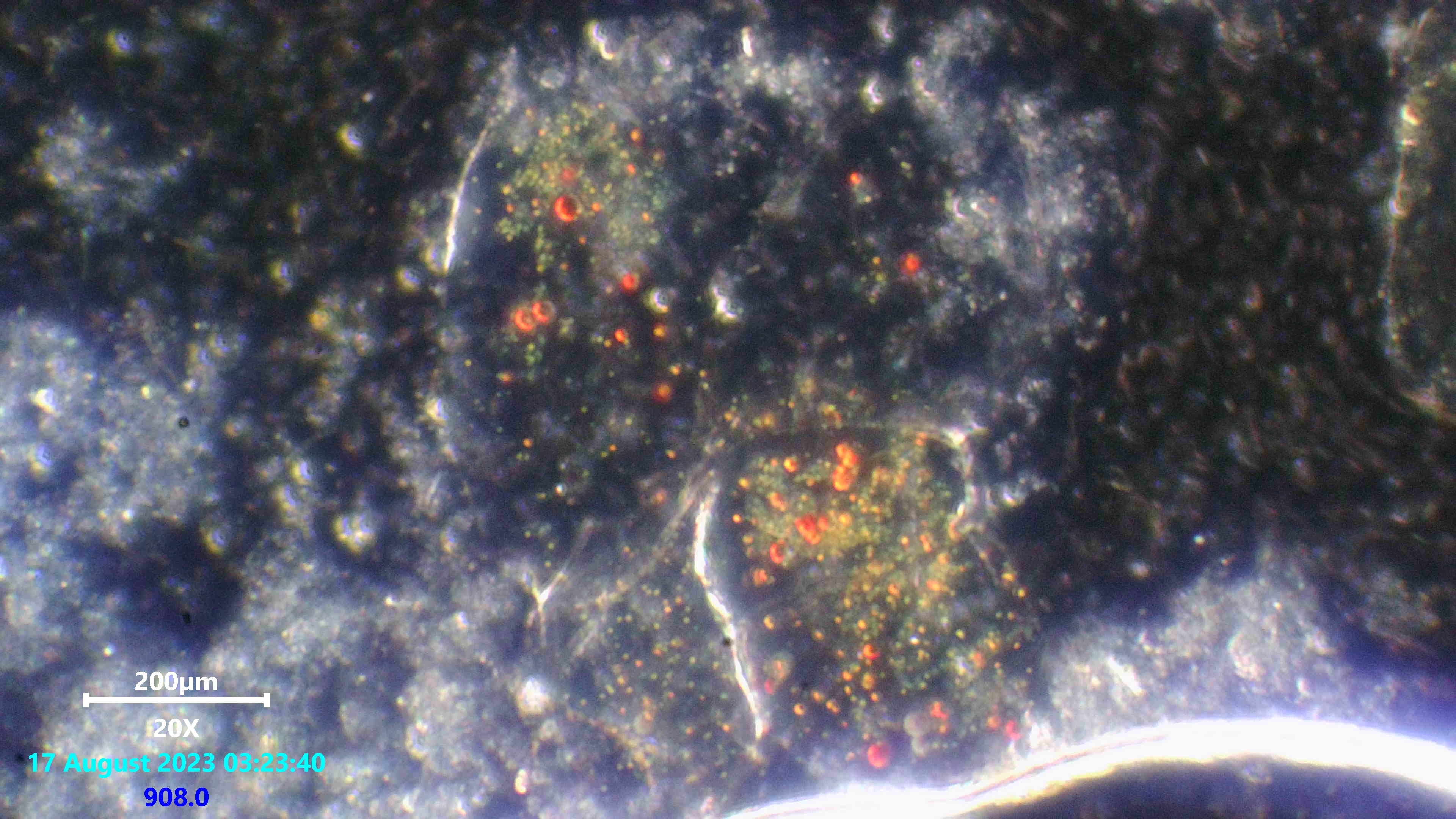 Stool sample shows UV reactive material and Q-dots.