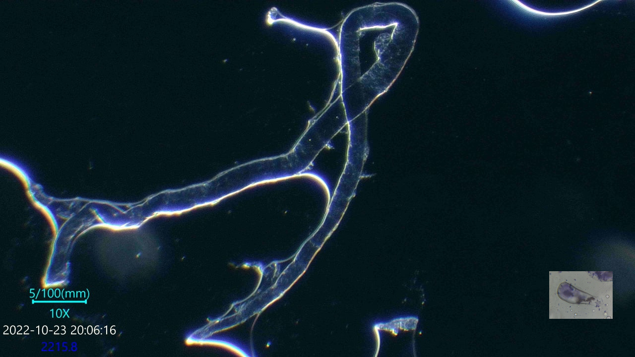 Test Hydrogel swab analysis part 2 - Karl.C’s Substack
