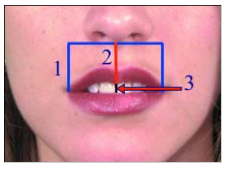 Changes in Frontal Soft Tissue Dimensions of the Lower Face by Age and ...