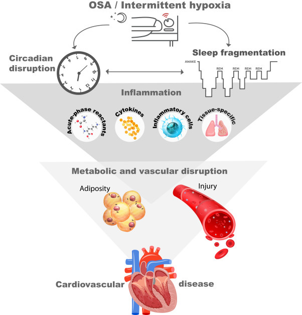 How Alcohol Affects Your Sleep - by Brady Holmer