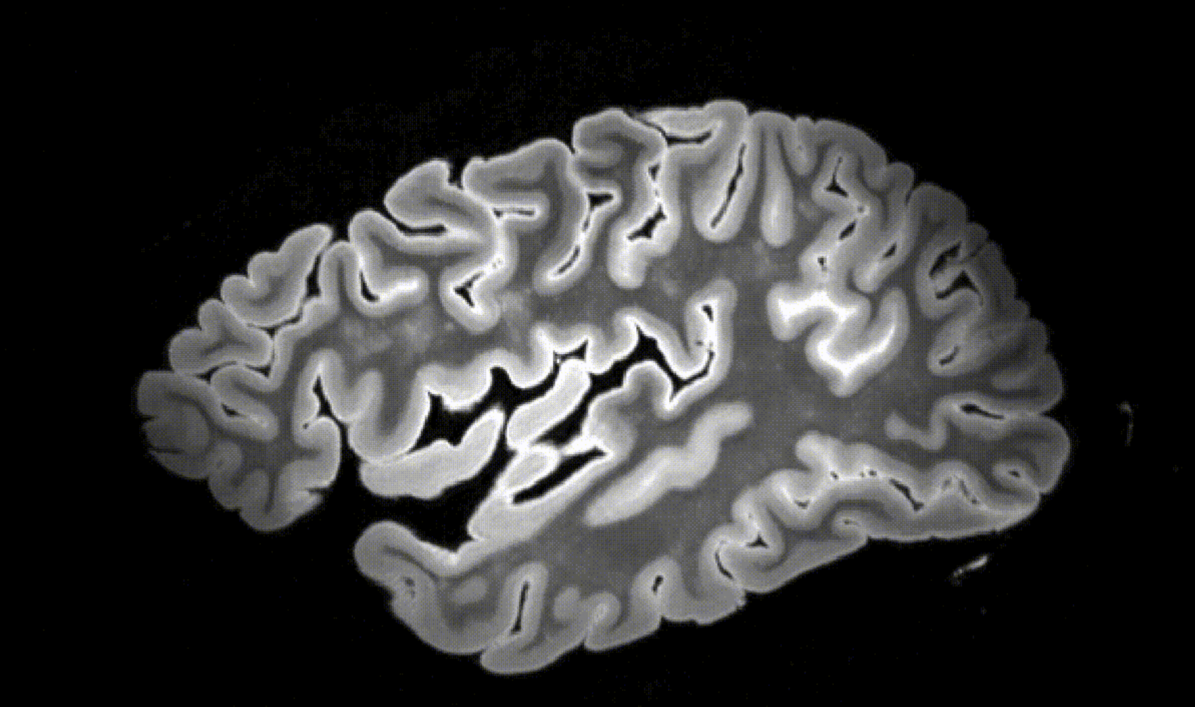 Enjoy this high-resolution scan of postmortem human brain
