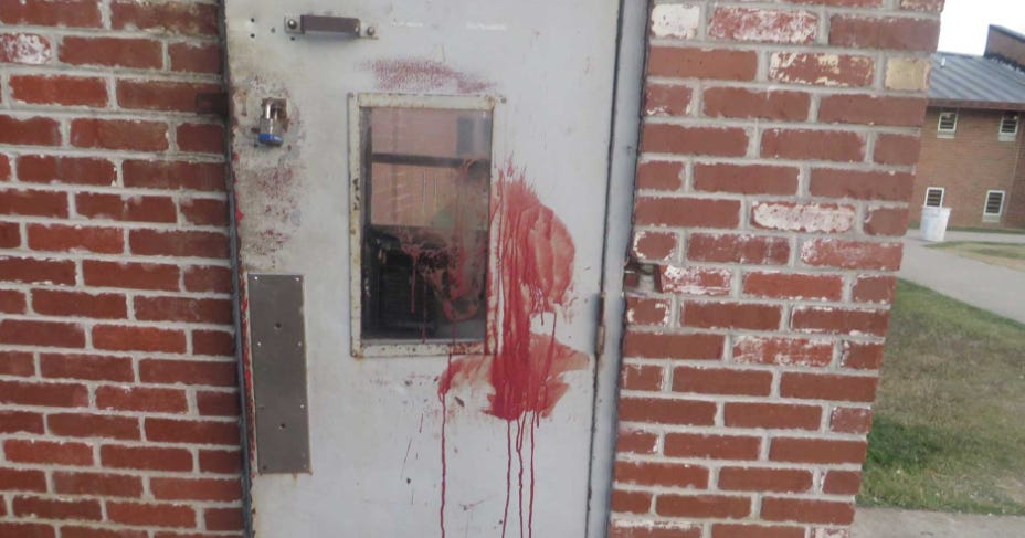 Unthinkable in the USA: Deadly Injustice in Alabama's Prisons