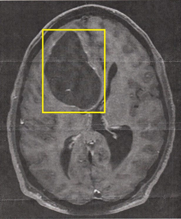 Start of the journey - by Andrew Jordan - Andrew’s Substack