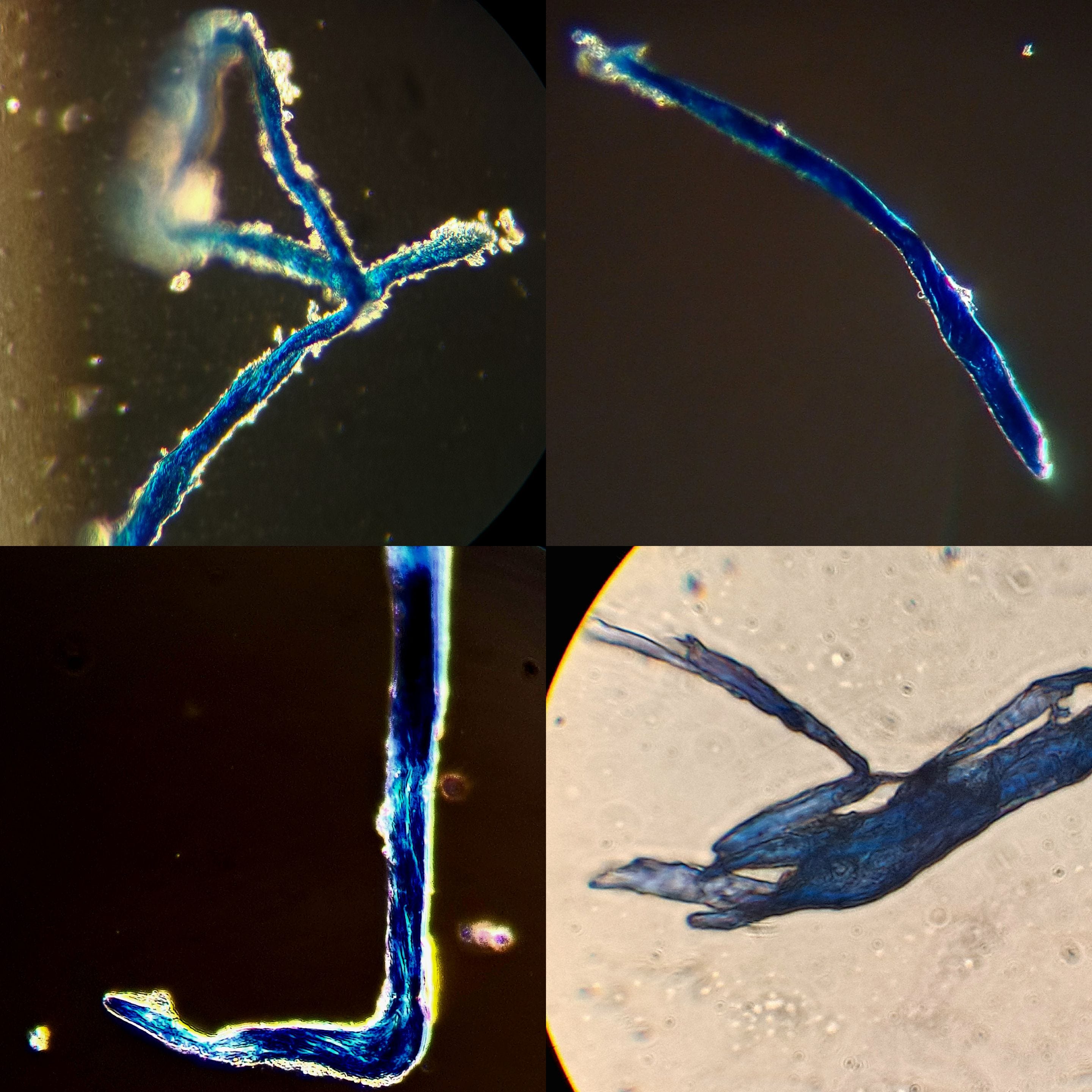 Identifying Environmental Fibers - Will: Micronaut