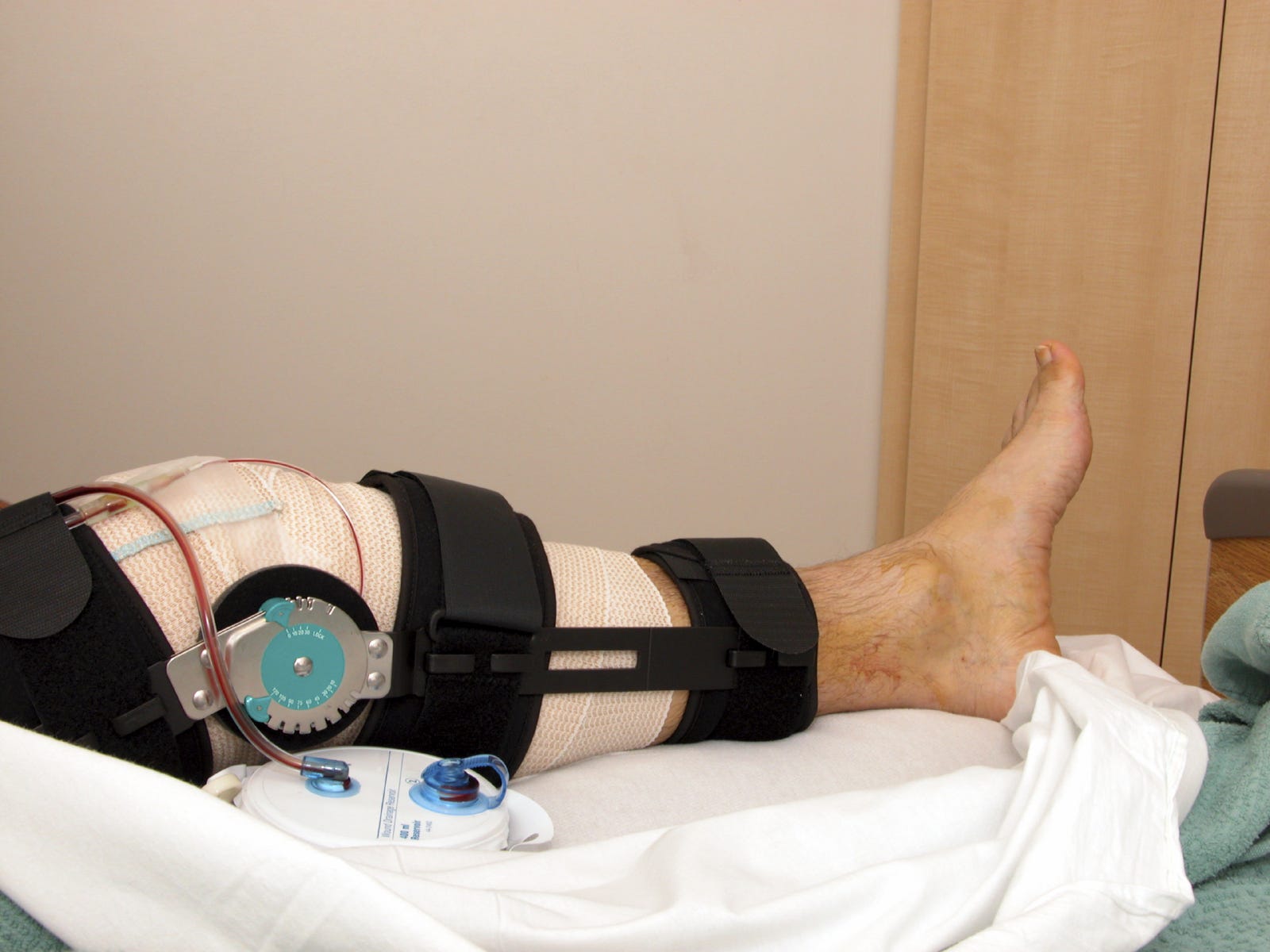 Anterior Cruciate Ligament (ACL) Reconstruction - Patellar Tendon ...