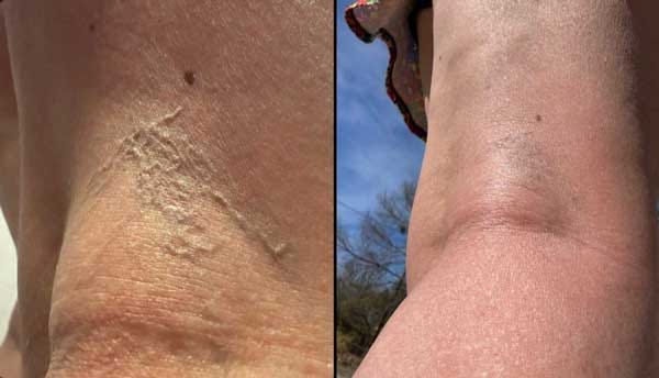 How DMSO Revolutionizes Skin Care and Dermatology