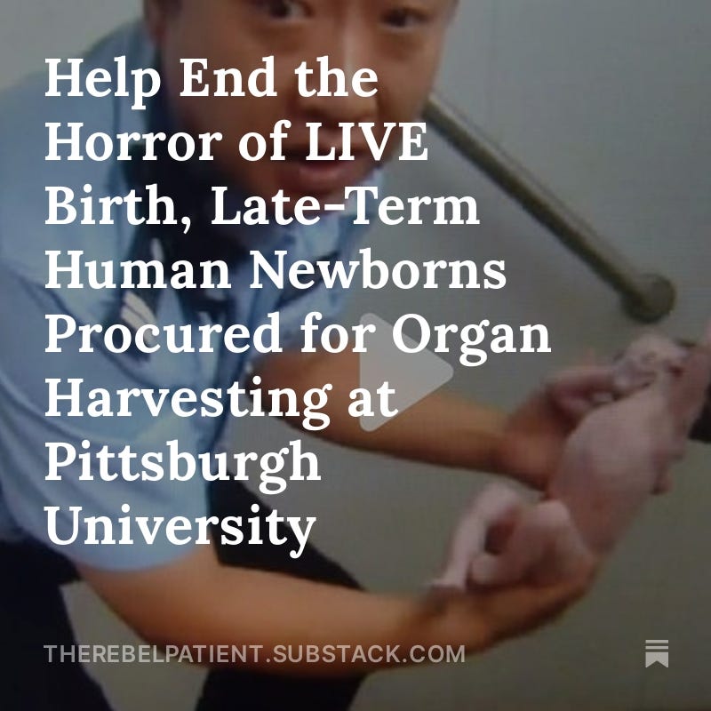 Help End the Horror of LIVE Birth, Late-Term Human Newborns Procured ...