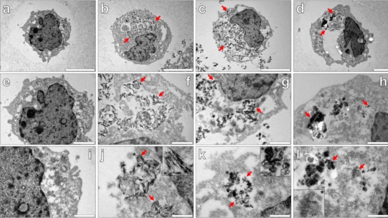 Why Do They Put Aluminum In Vaccines? The Difference Between Injection ...