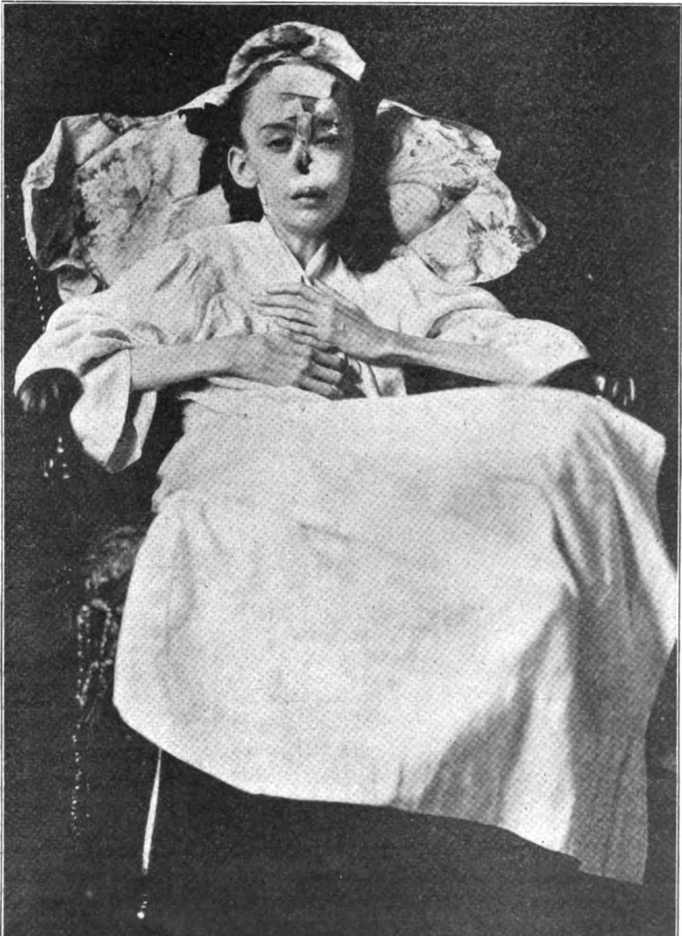 The Story of Smallpox and Vaccination