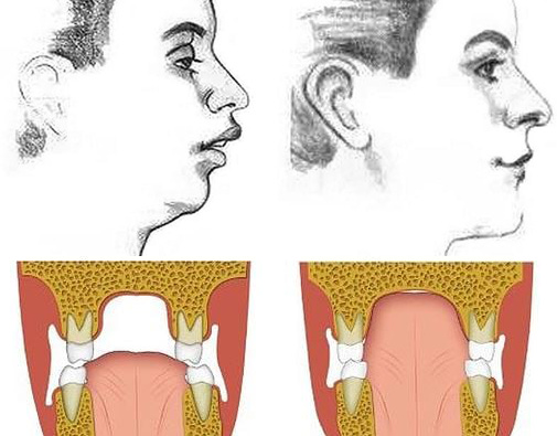 2.3 Mewing is More Than Just Tongue Posture - by Ronald Ead