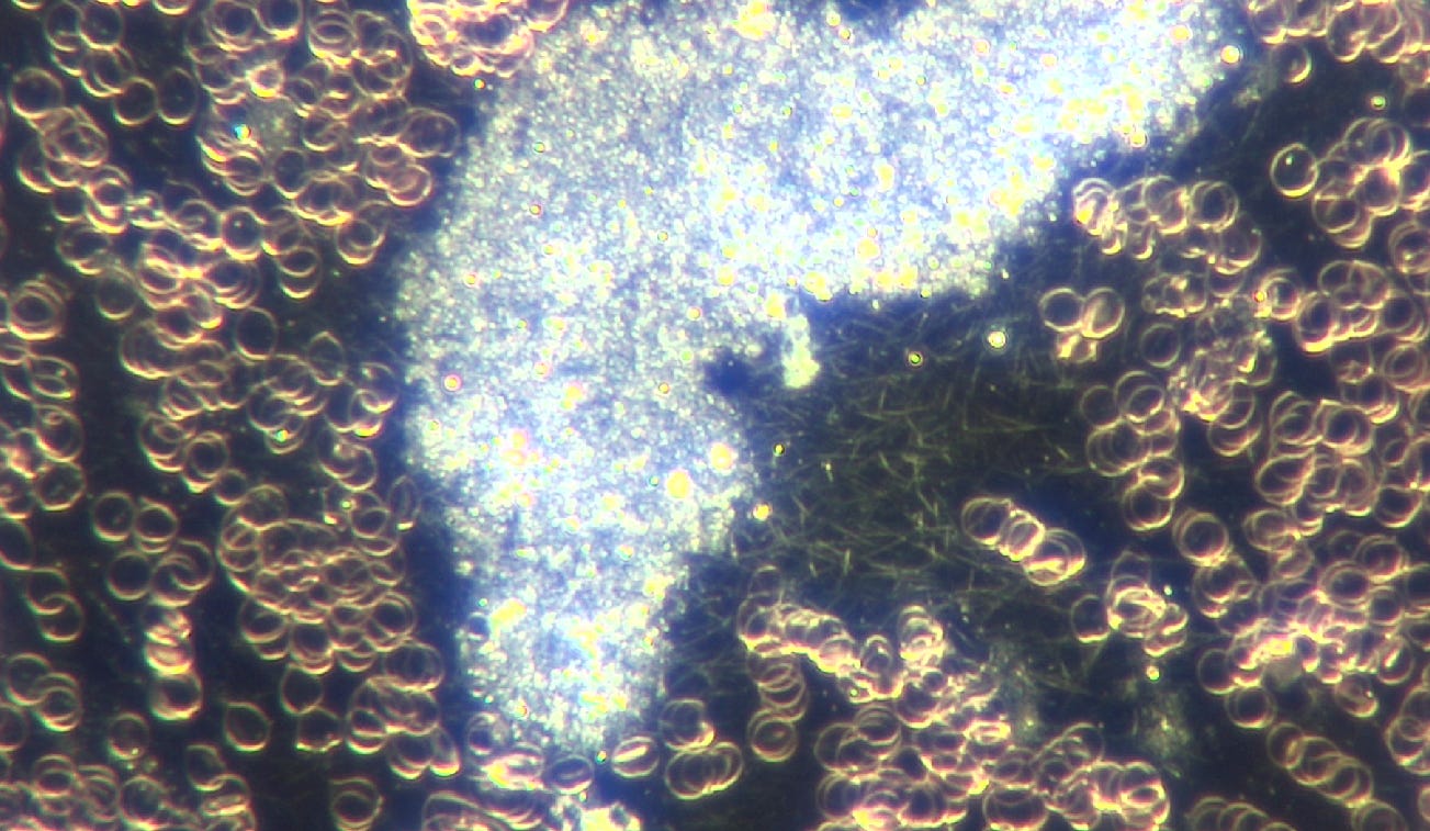Darkfield Microscopy of Pneumococcal Vaccine Prevnar 13 Shows Quantum ...