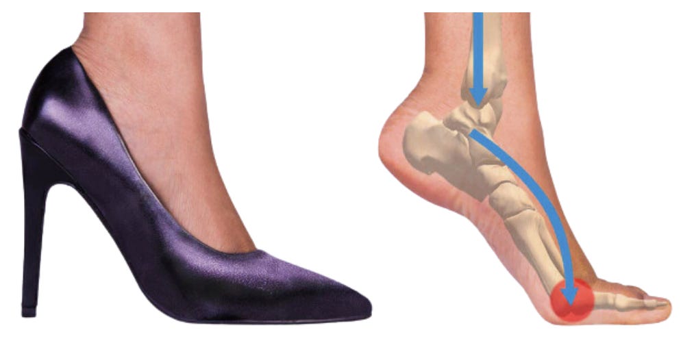(Part 3) Women & Shoes - Modern Day Foot Binding, Cannes Controversy ...