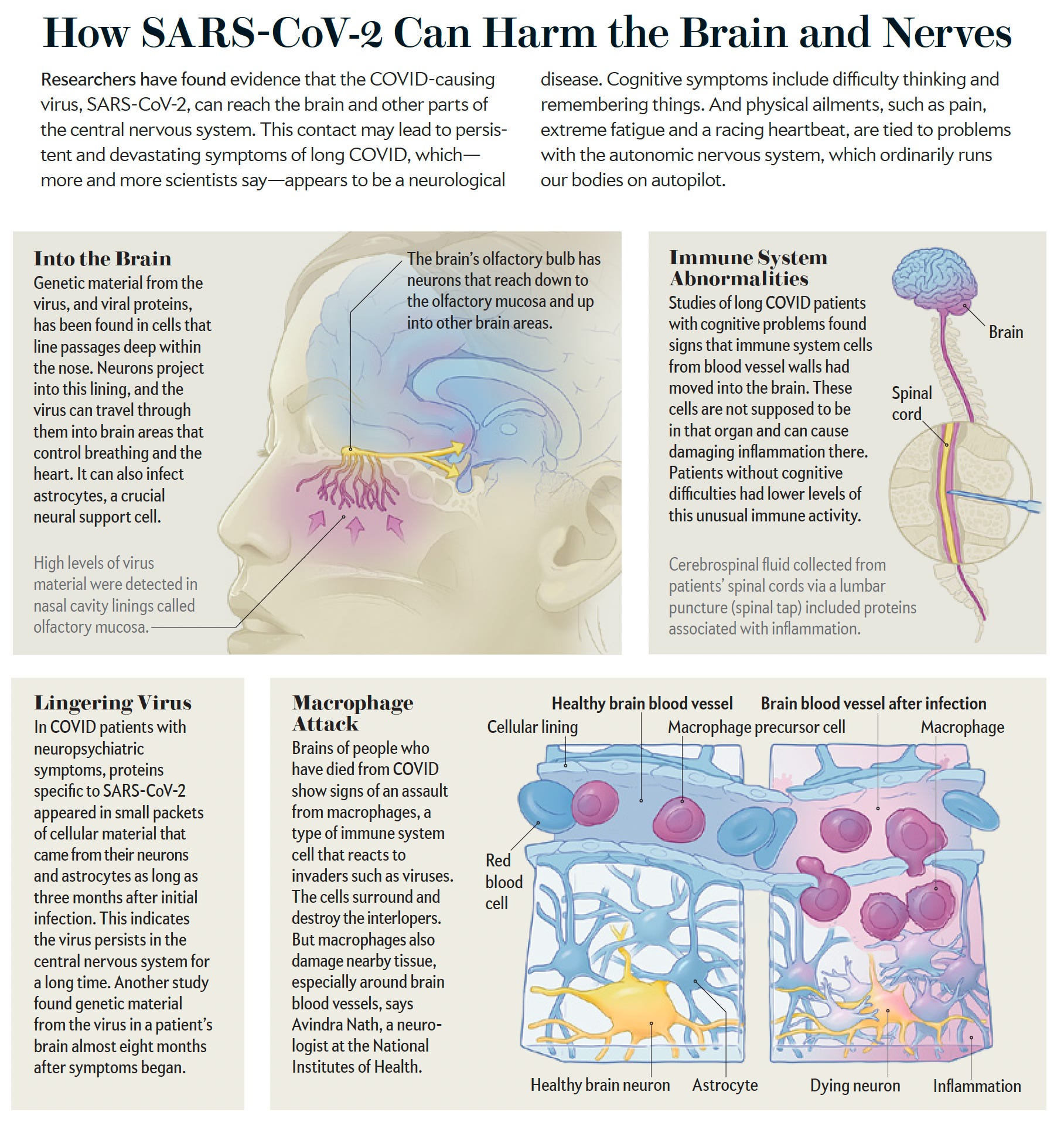 The Brain and Long Covid - by Eric Topol - Ground Truths
