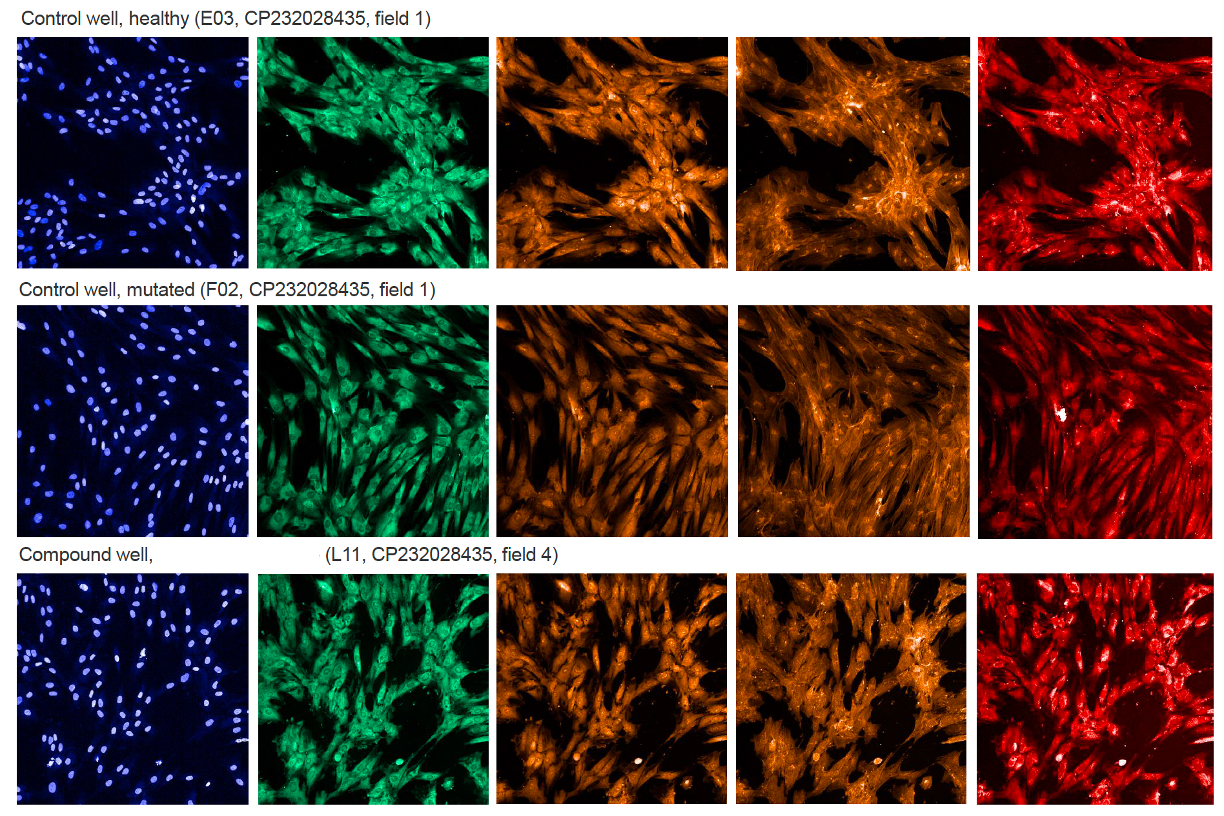 PACS2 drug repurposing pilot screen