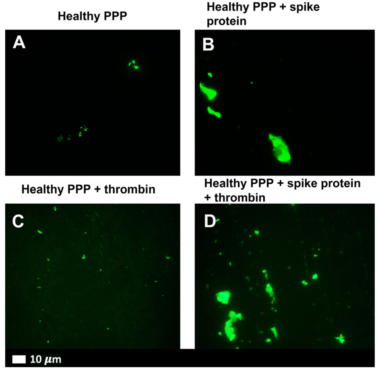 Deep dive: microclots in long COVID - by Janna Moen, PhD