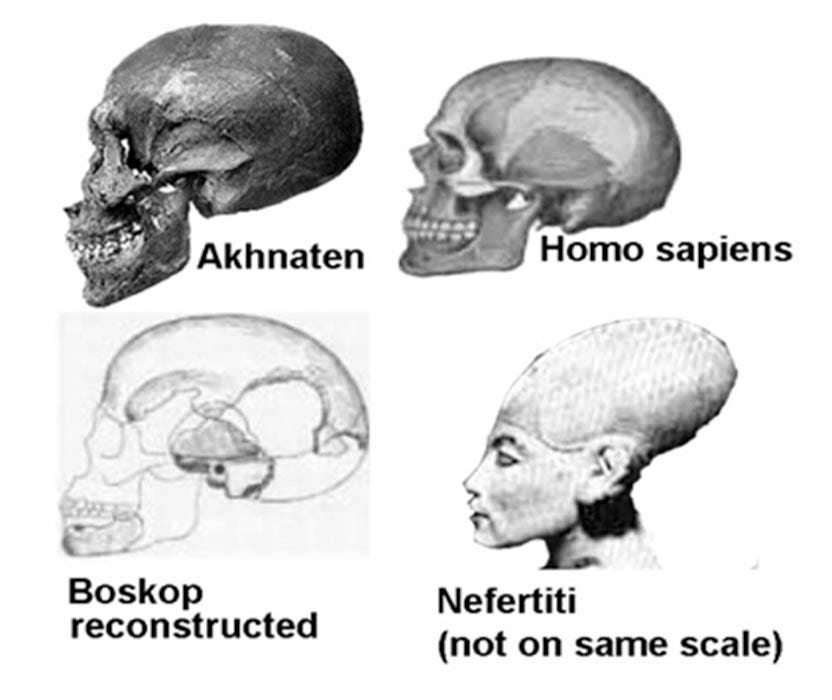 Gods of Antiquity: Elongated Skulls From Africa