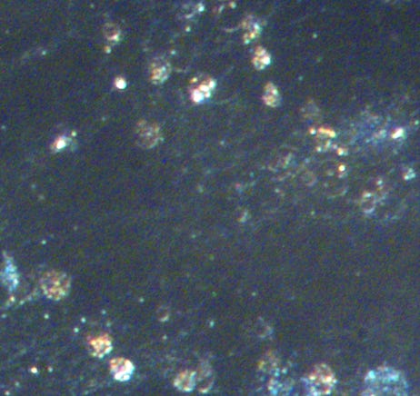 Hydrogen Peroxide added to blood reveals highly concentrated amounts of ...