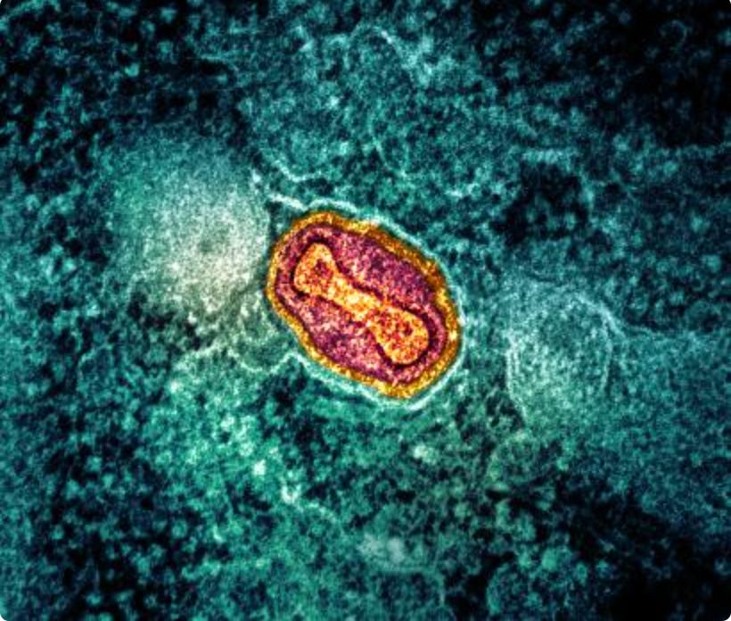 MPox/Monkeypox: Summer 2024 Update