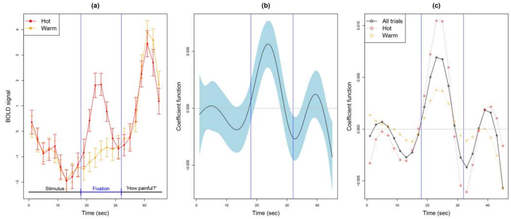 What is functional data analysis? - by Christian Pascual