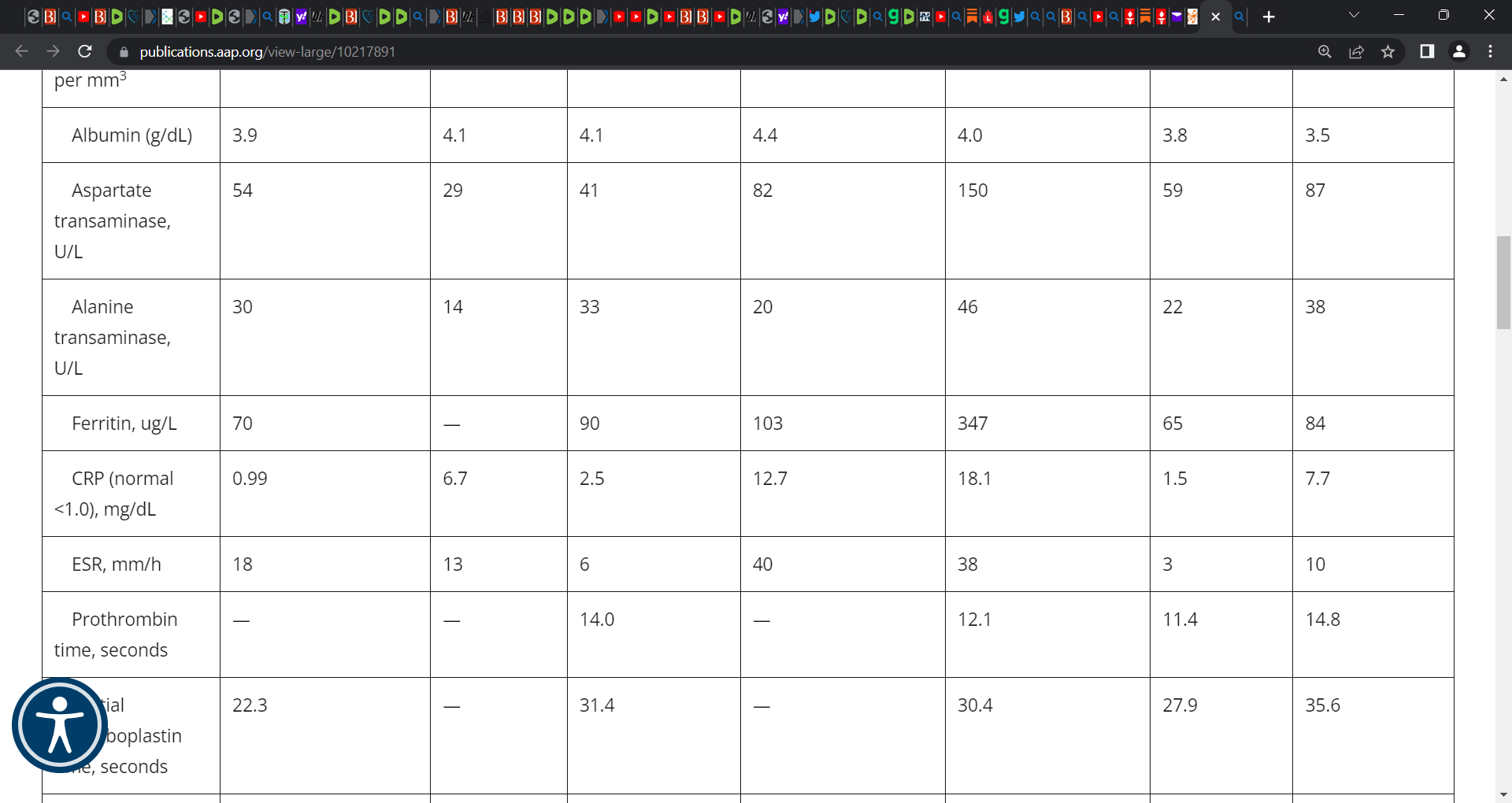 7 adolescents with Symptomatic Acute Myocarditis After Pfizer-BioNTech ...