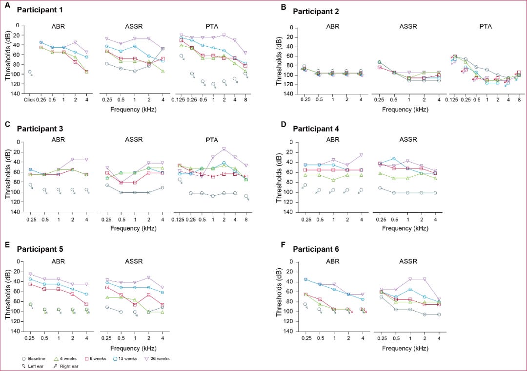 World First Gene Therapy Restores Hearing in Patients with Genetic Deafness