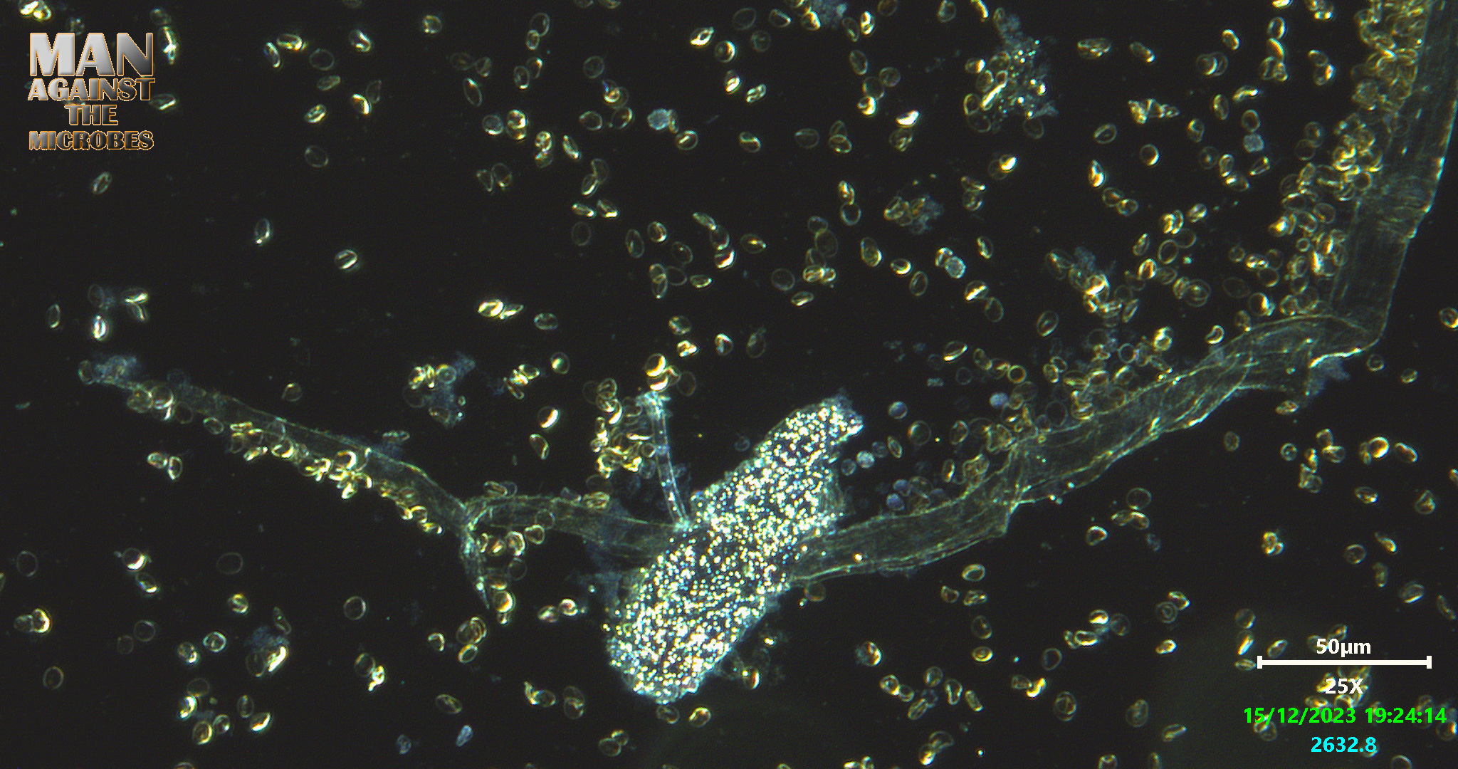 The origin of blood abnormalities is easy to see!