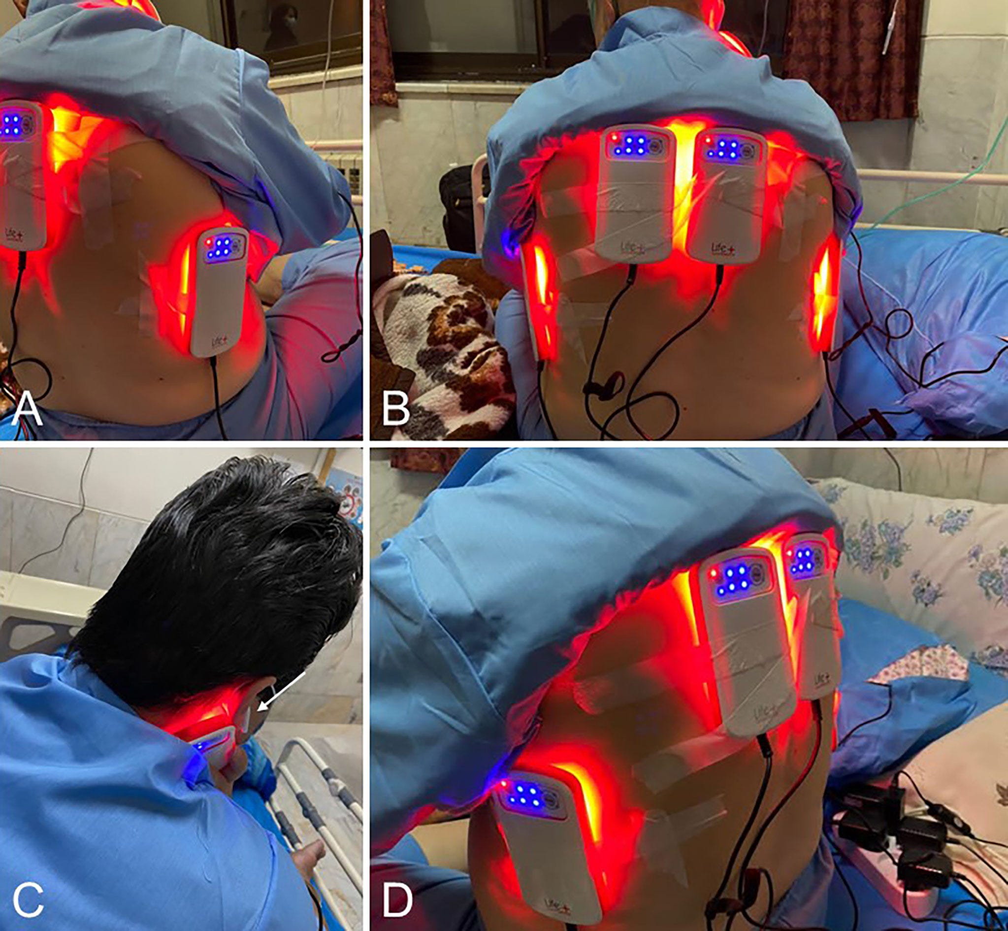 Covid PhotoBioModulation/Light Therapy Studies - by nidal