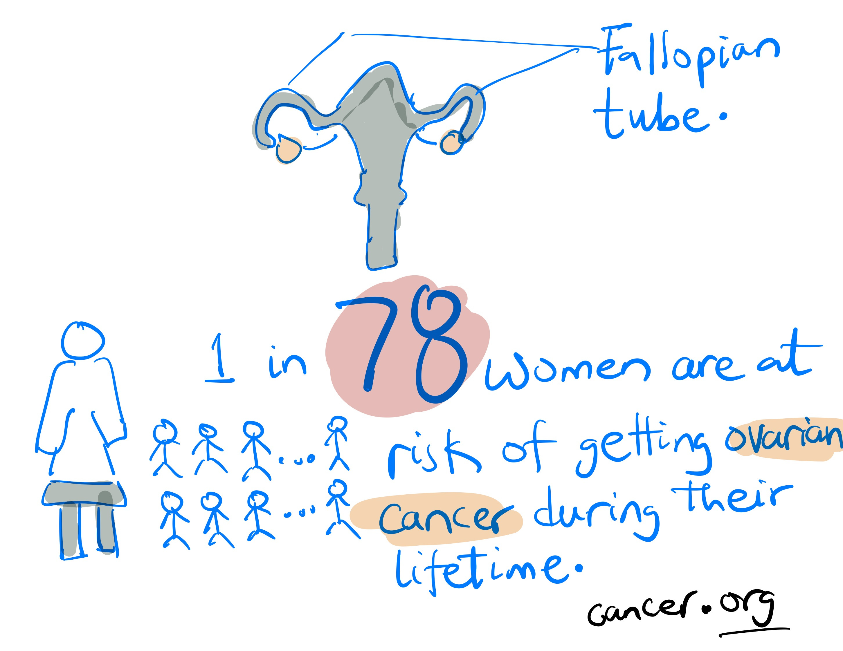 Machine Learning Reveals Ovarian Cancer Progression