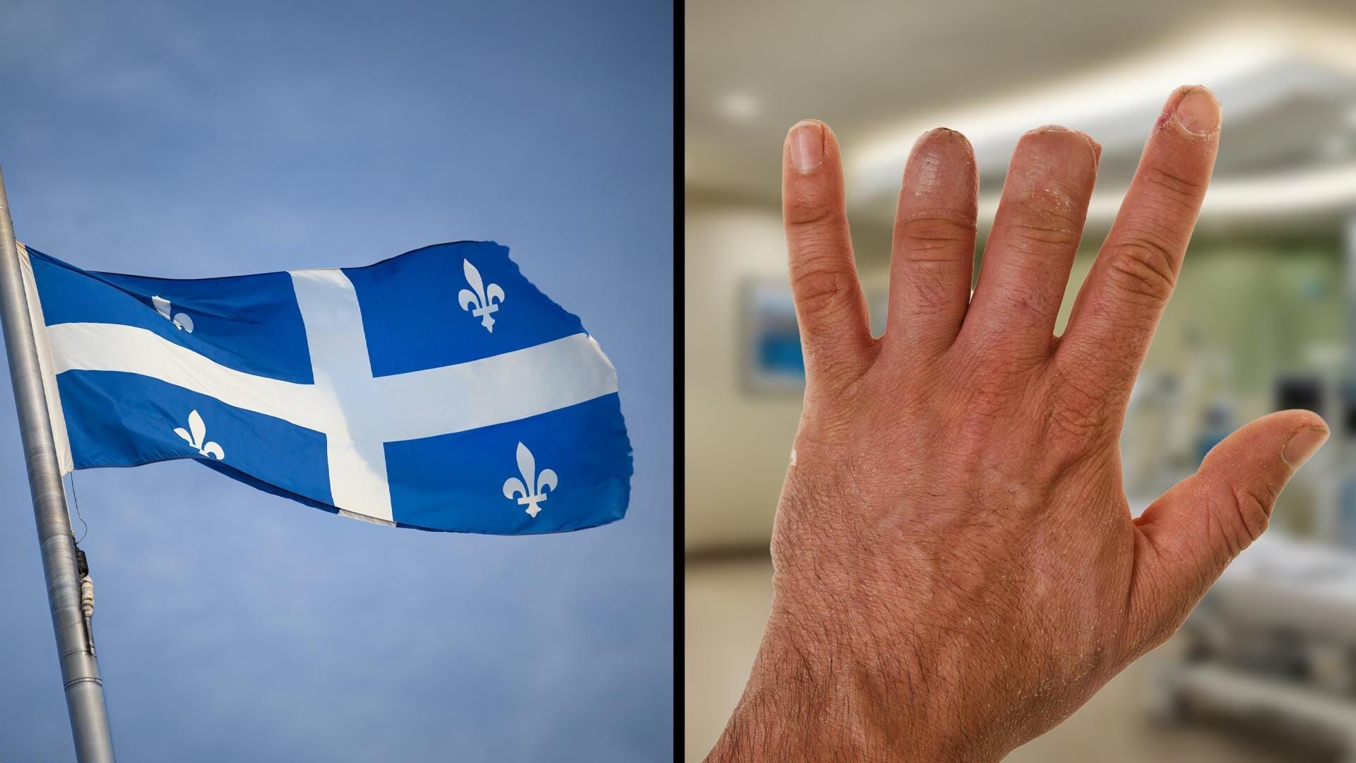 The emerging trend of transableism - Collapse Life