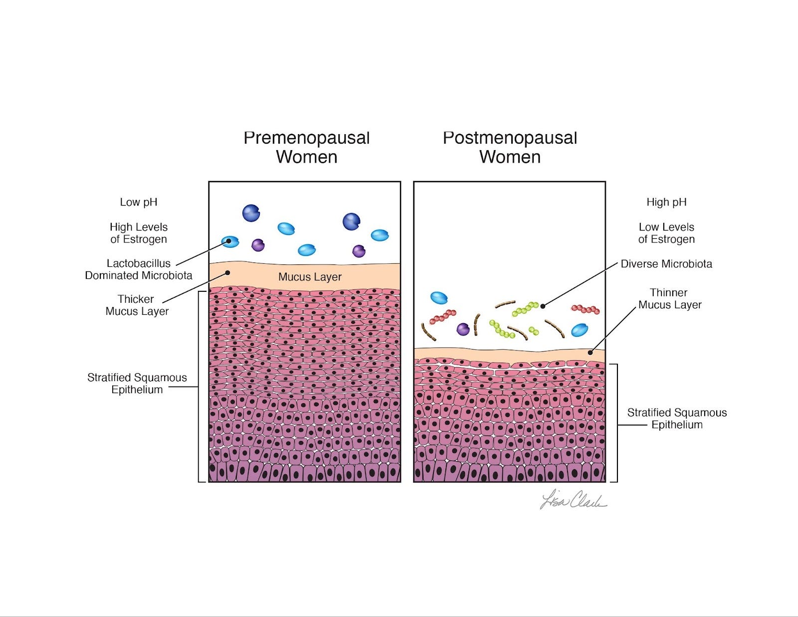 Genitourinary Syndrome of Menopause - by Dr. Jen Gunter