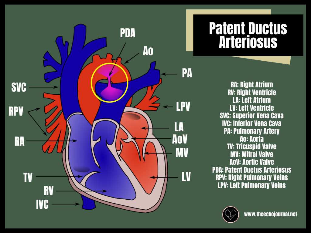 PDA: Seeing the Flow - by Alex C. - The Echo Journal