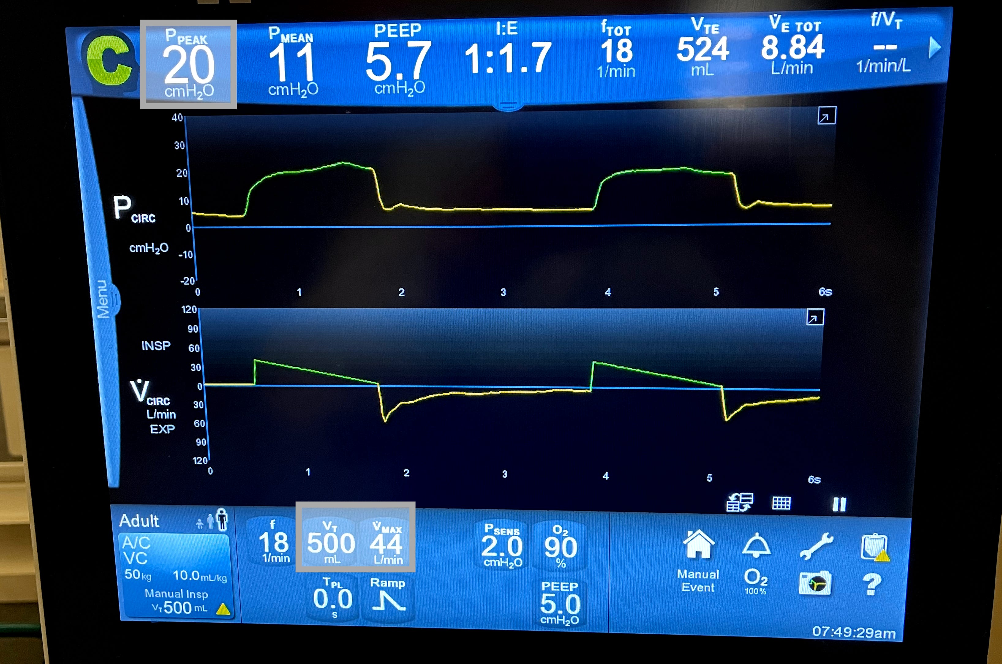 Mechanical Ventilation Made Simple: 9 Concepts Every Non-ICU Doc Should ...
