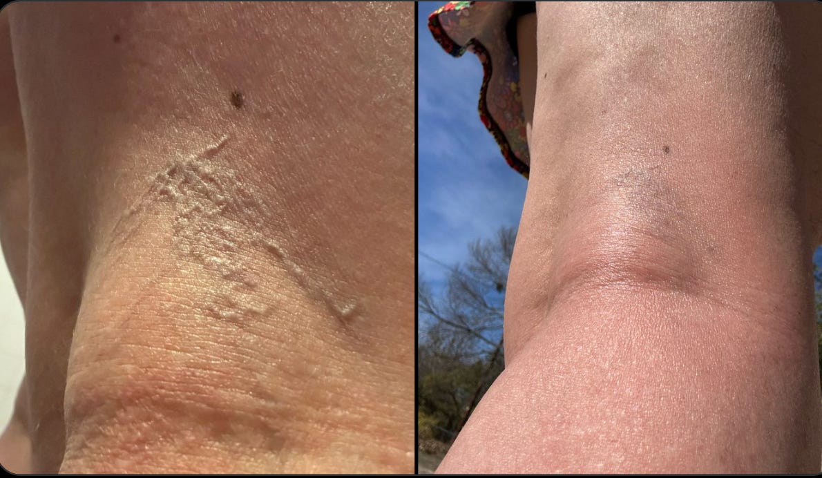 DMSO Revolutionizes Skin Care and Dermatology